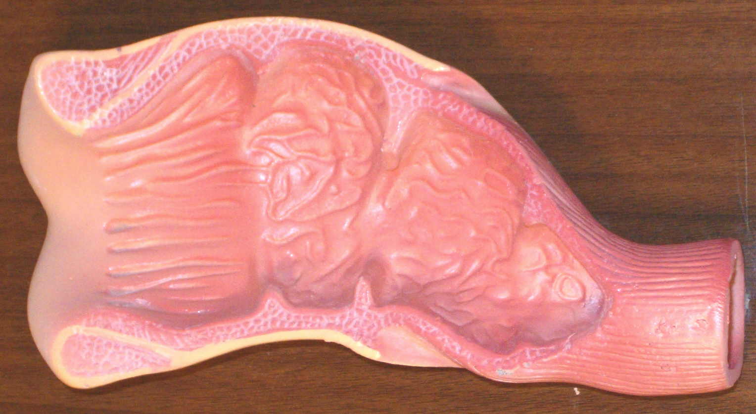 Internal Antrum Of The Rectum Model